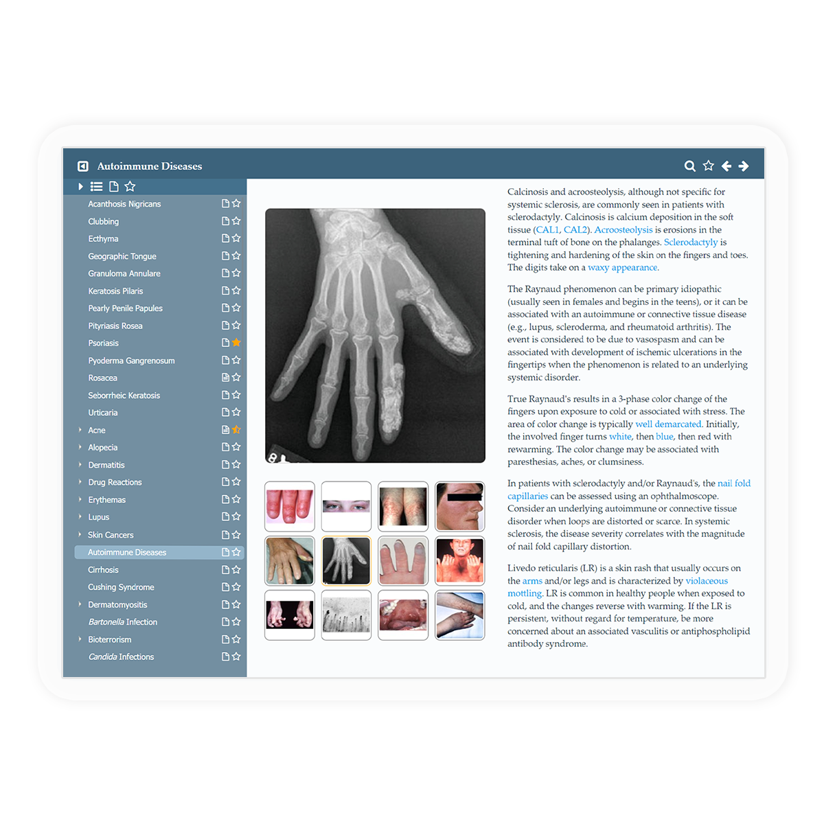 Skin Signs – MedStudy