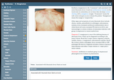 Skin Signs – MedStudy